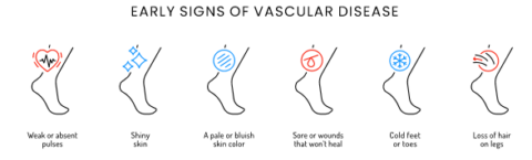 Warning Signs You May Have Poor Circulation